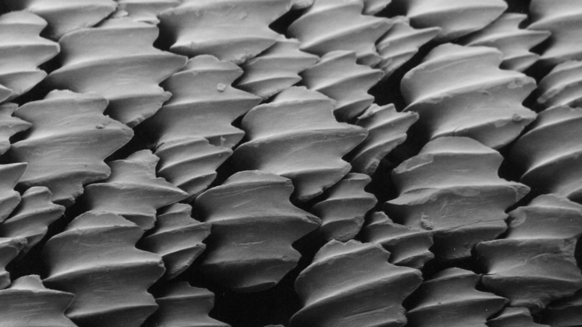 From Fish Skin to Our Teeth: Tracing the Origin of Enamel | KQED