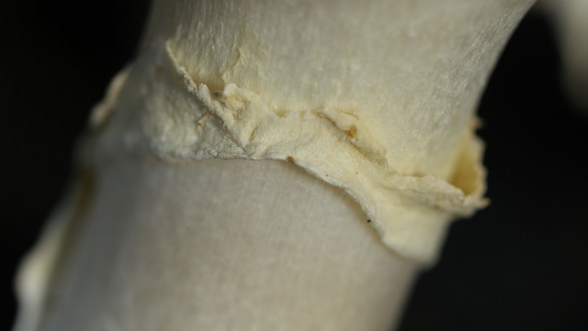 This Mushroom Starts Killing You Before You Even Realize It | KQED