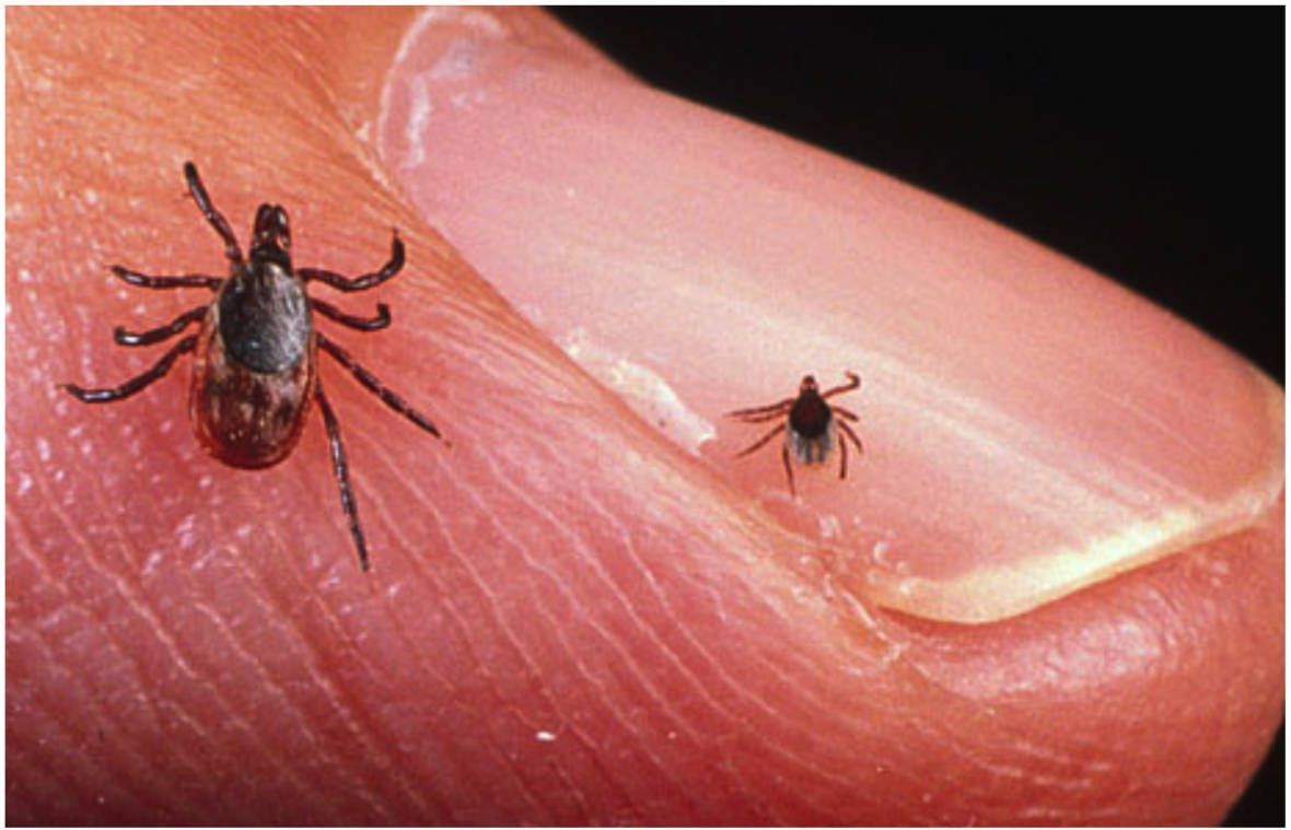 Know How to Protect Yourself From Lyme Disease on Bay Area Hikes | KQED