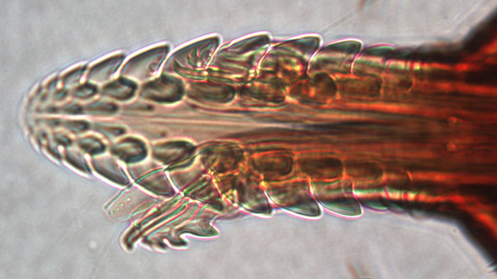 How Ticks Dig In With a Mouth Full of Hooks | KQED